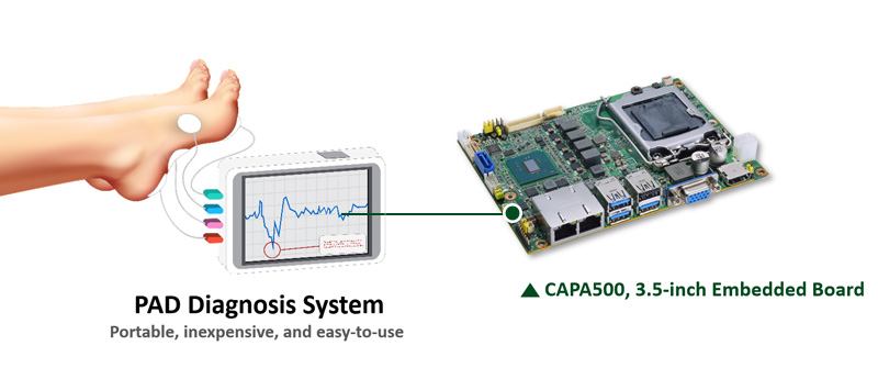 Subdermal Noninvasive Monitoring System